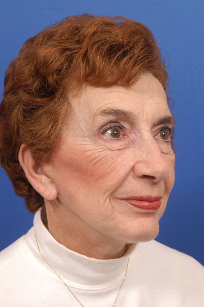 Before and After Photos Denver - Plastic Surgery Gallery Dr. John Millard